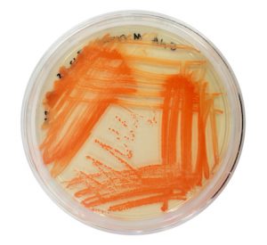 Microbiology: Resources for schools – NCBE